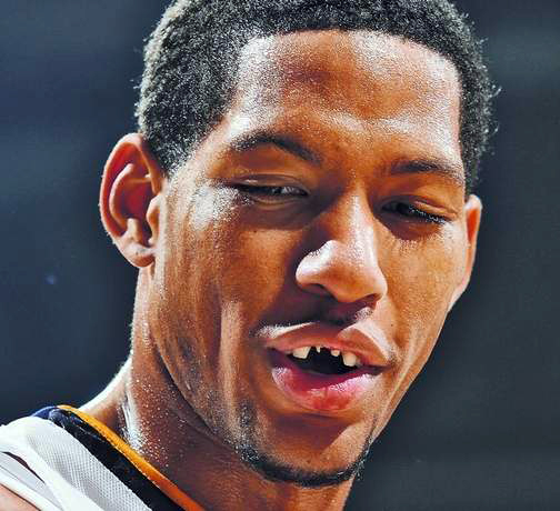 10 Times NBA Players Got Teeth Knocked Out | New Generation Dentistry